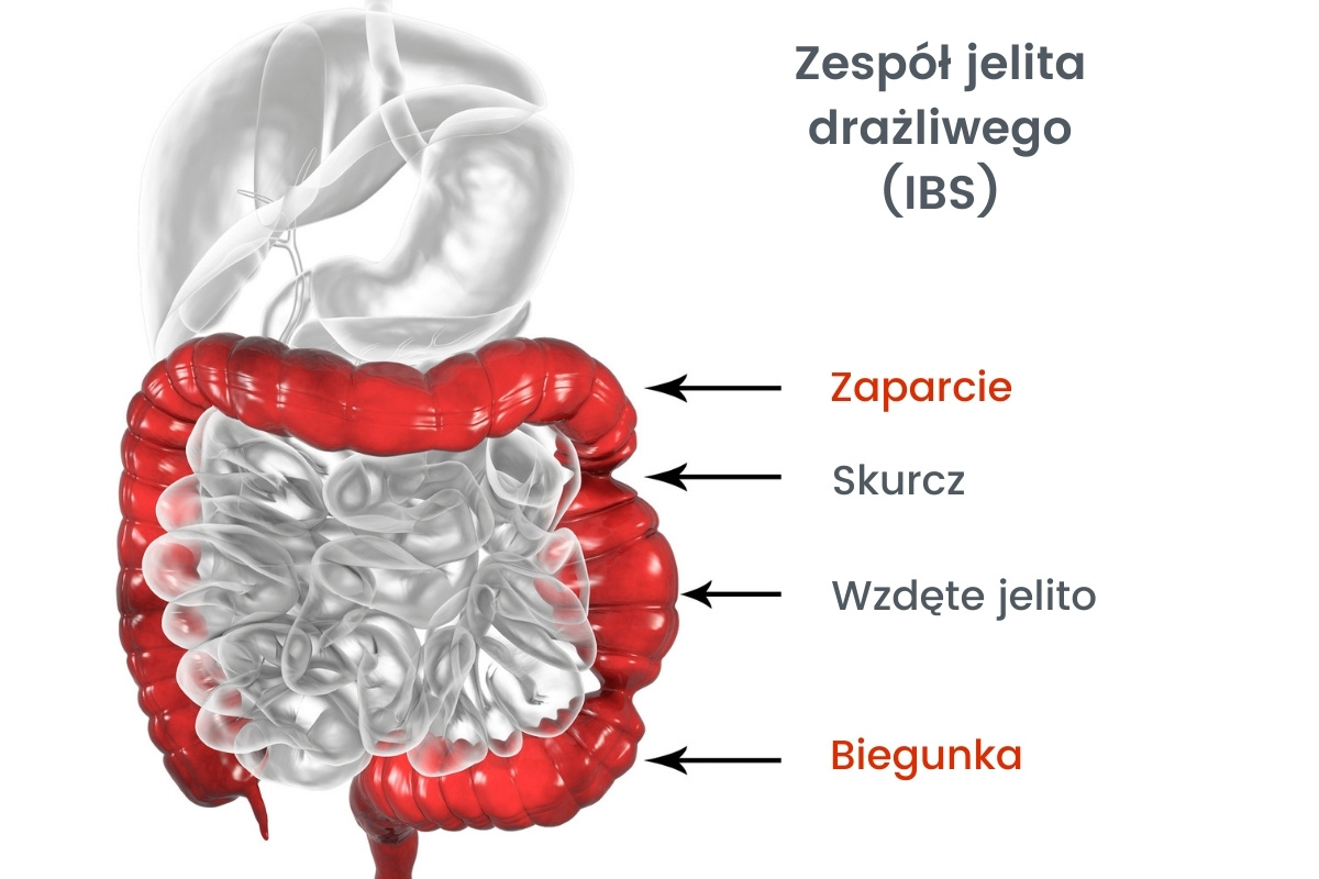 Zespół Jelita Drażliwego - Przyczyny, Objawy, Leczenie | Apteka Zdrowie ...