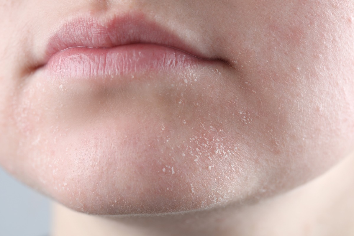 Sucha skóra twarzy i ciała: pielęgnacja | Apteka Zdrowie