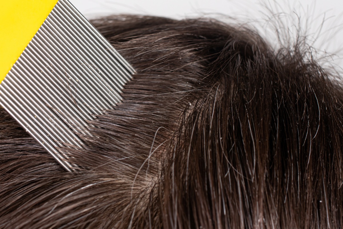 Jak Skutecznie Pozbyć Się Wszy? Domowe Sposoby na Wszawicę | Apteka ...